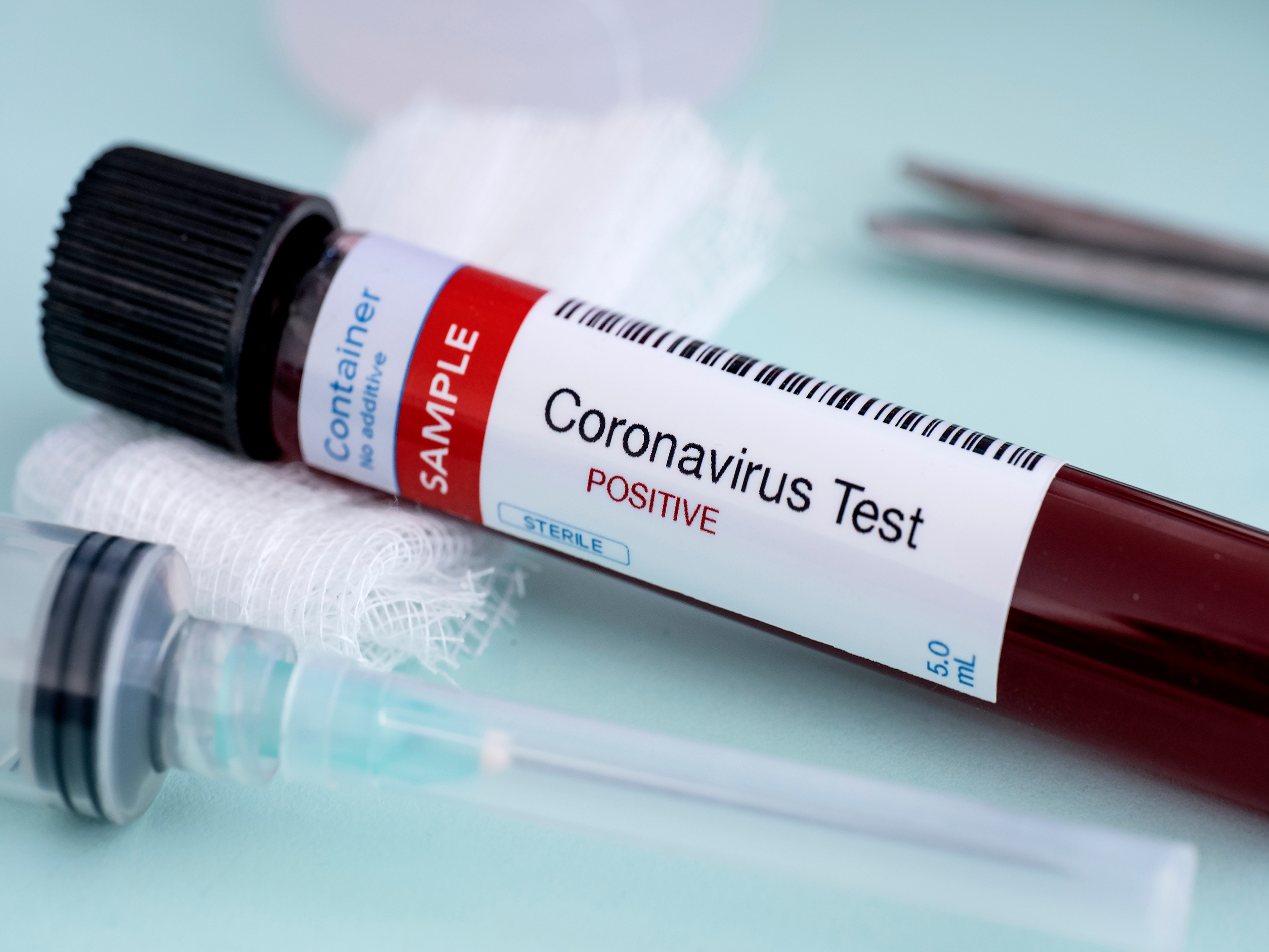 Coronavirus Test Results Are Faster but Still Too Slow for Contact ...