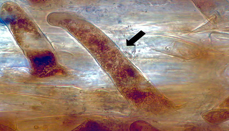 Symbiotic Bacteria In Root Cells May Be Key To Producing Better Crops ...