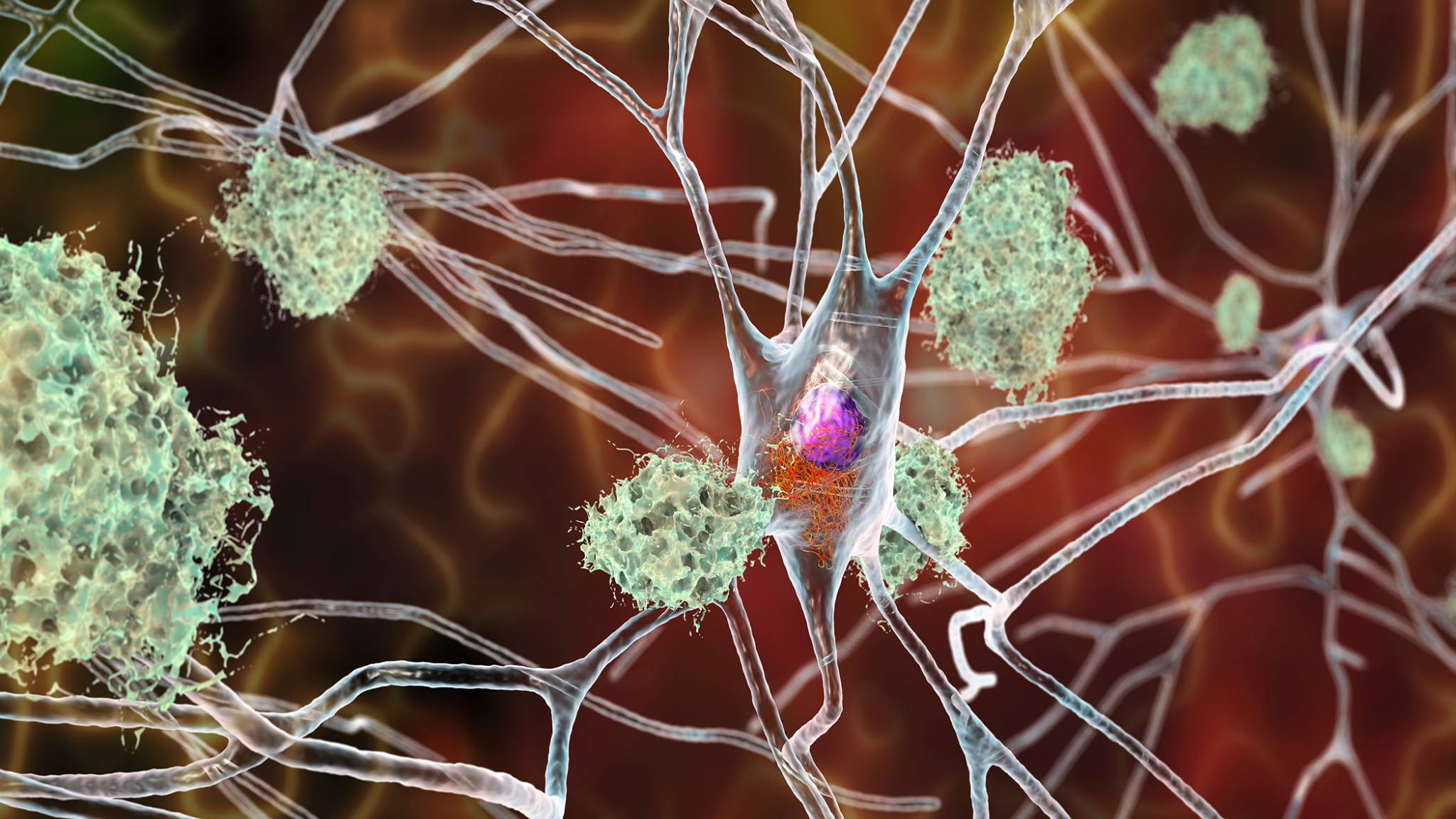 Study Explains How “Zombie” Cancer Cells Revive Themselves | Rutgers ...